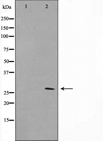 KDELR3 Antibody | Affinity Biosciences LTD|亲科生物官网