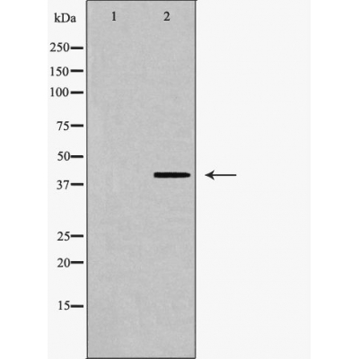 GPR120 Antibody | Affinity Biosciences LTD|亲科生物官网