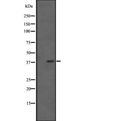 FPRL1 Antibody | Affinity Biosciences LTD|亲科生物官网