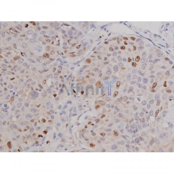 Ki67 Antibody | Affinity Biosciences