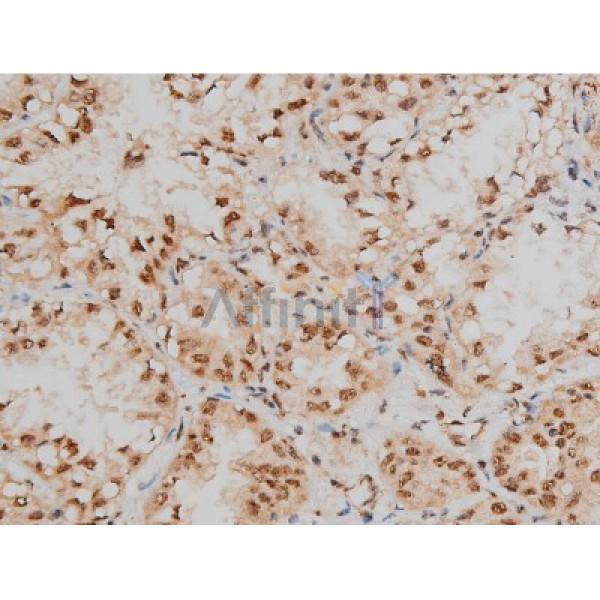 Phospho-CREB (Ser133) Antibody | Affinity Biosciences