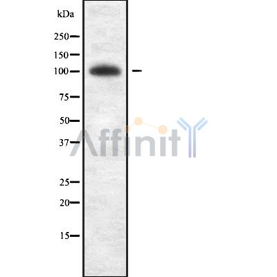 OPA1 Antibody | Affinity Biosciences LTD|亲科生物官网