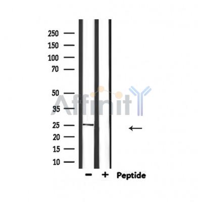 CD9 Antibody | Affinity Biosciences