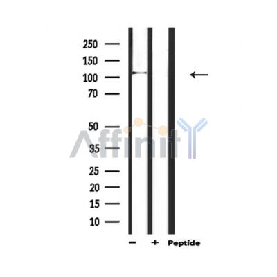 BMPR2 Antibody | Affinity Biosciences LTD|亲科生物官网