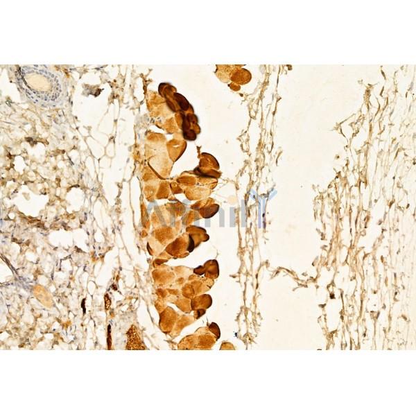 Occludin Antibody | Affinity Biosciences