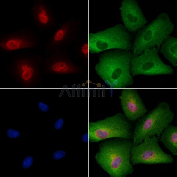 Phospho-TFEB (Ser211) Antibody | Affinity Biosciences LTD|亲科生物官网