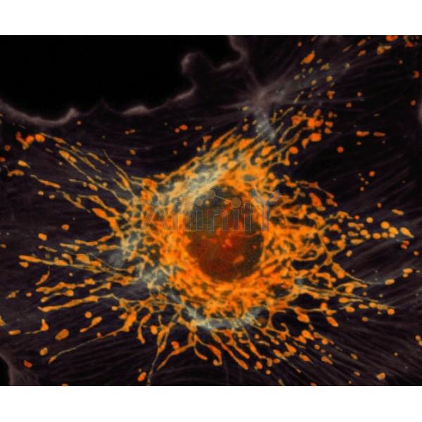 SM22 alpha Antibody | Affinity Biosciences LTD|亲科生物官网