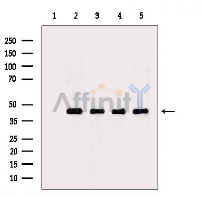 SM22 alpha Antibody | Affinity Biosciences LTD|亲科生物官网