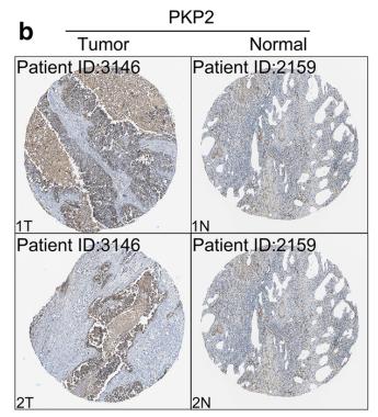PKP2 Antibody | Affinity Biosciences