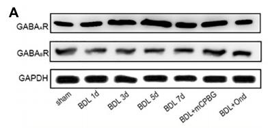 GABBR1 Antibody | Affinity Biosciences LTD|亲科生物官网